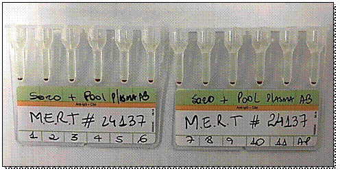 Anticuerpos anti-Chido/Rodgers en paciente con enfermedad infecciosa ...